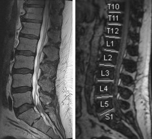 MRT - Diagnosezentrum Mödling